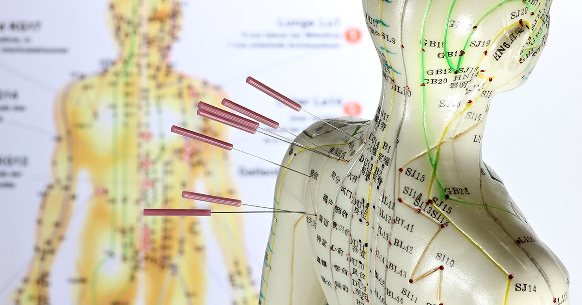 Beyond the Needle: The Surprising Medical Training of Acupuncturists ...
